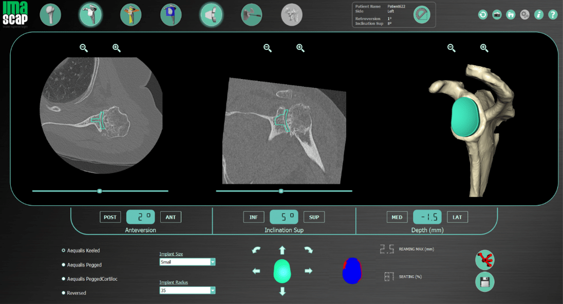 Pr Pascal Boileau - Institut de Chirurgie Réparatrice Locomoteur & Sport