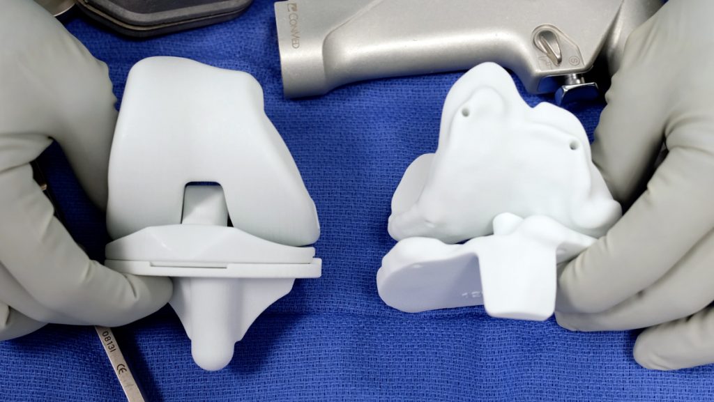 Pose de la 1ère prothèse totale de genou sur mesure à l'ICR - Institut ...