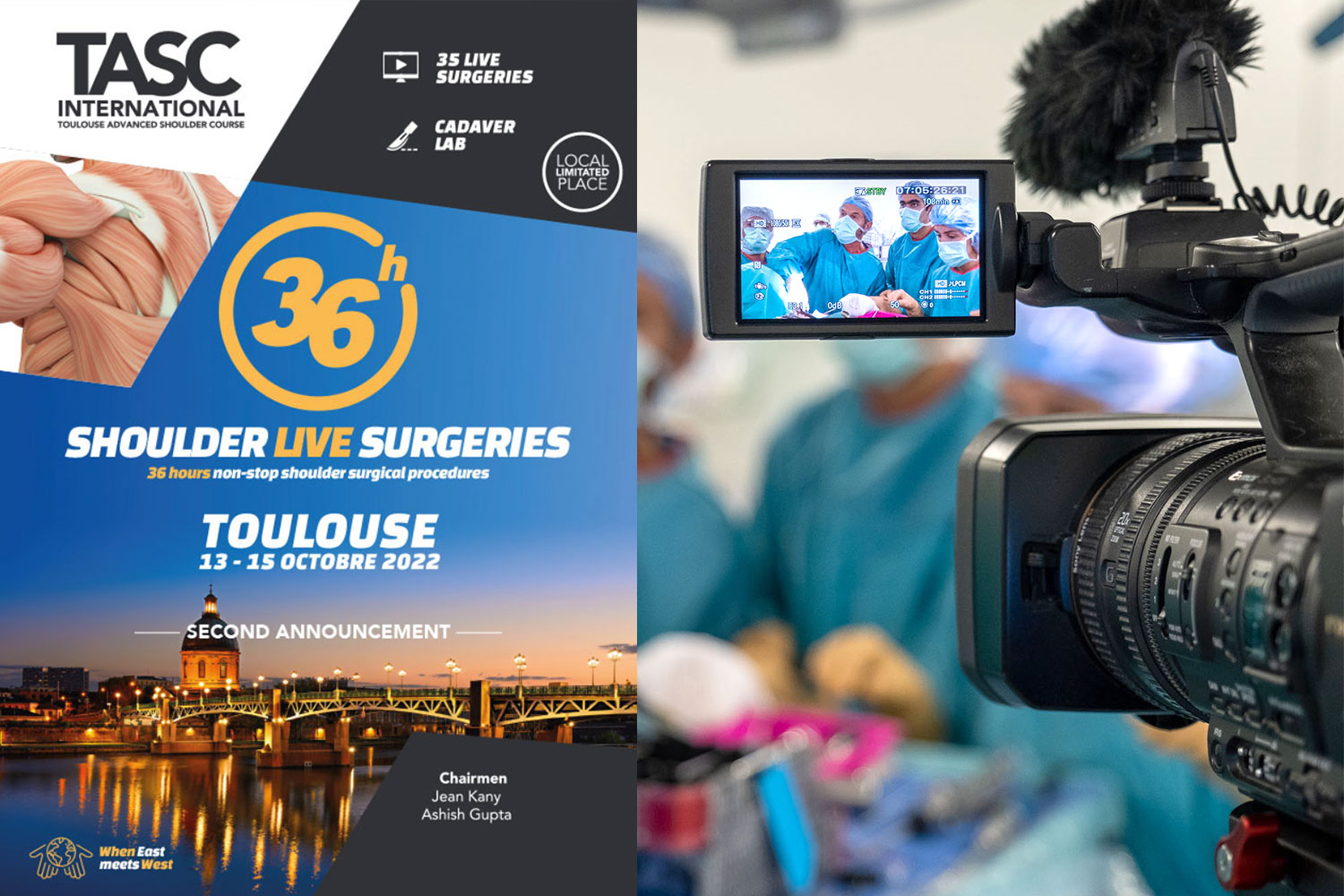 TASC 2022, 36 heures de chirurgie non stop ! Opération en direct du Pr ...