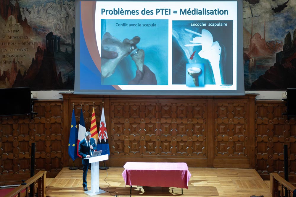 [Conférence] La prothèse inversée de l'épaule, des résultats ...